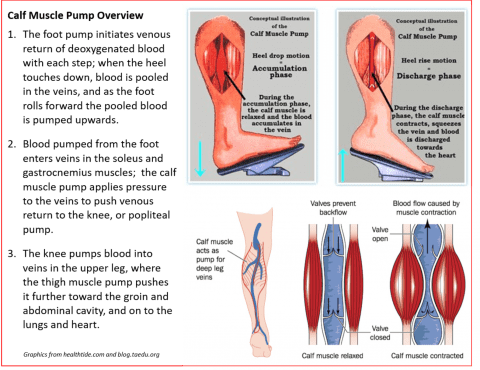 Calf Muscle Pump | Steinmann Prosthetics & Orthotics