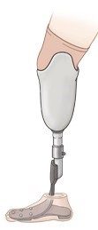 prosthetics, definitive, preparatory, K-Level, stump shrinker, phantom ...