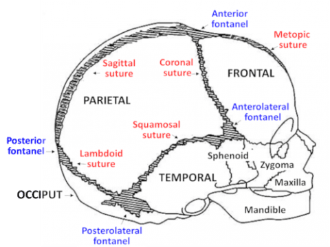 head shape, plagiocephaly, craniosynostosis, torticollis, brachycephaly ...